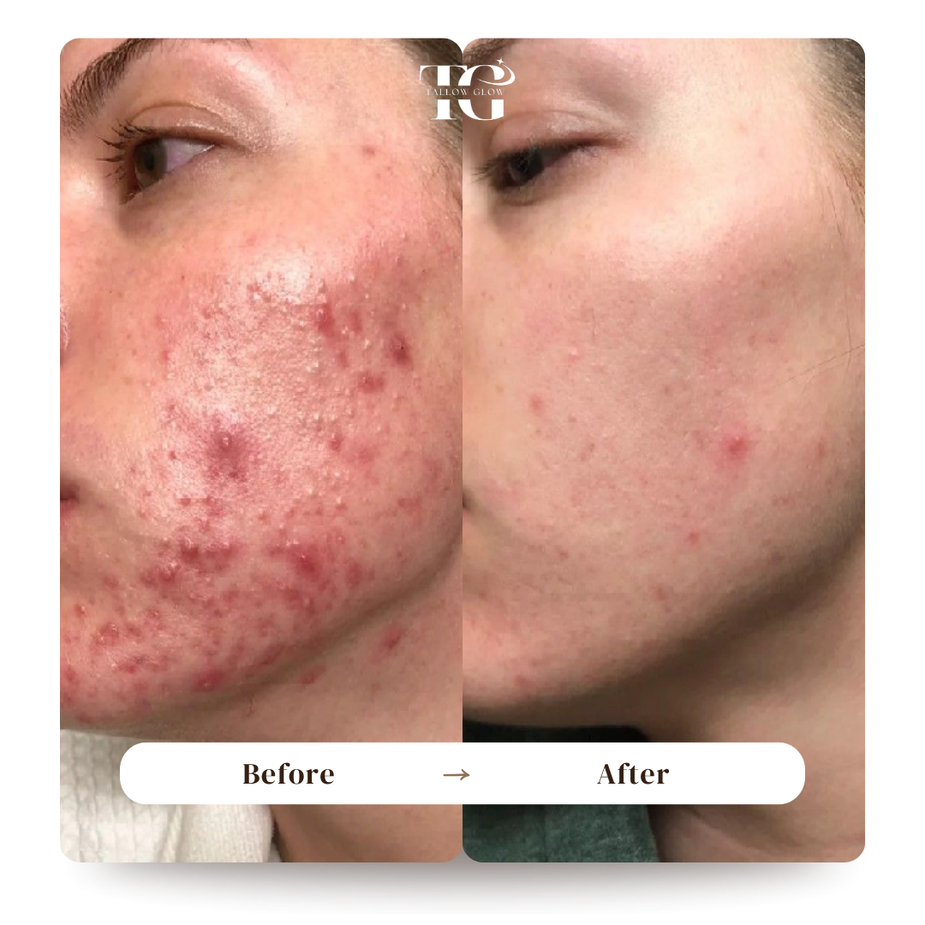 Tallow Glow | #1 Tallow in Nederland