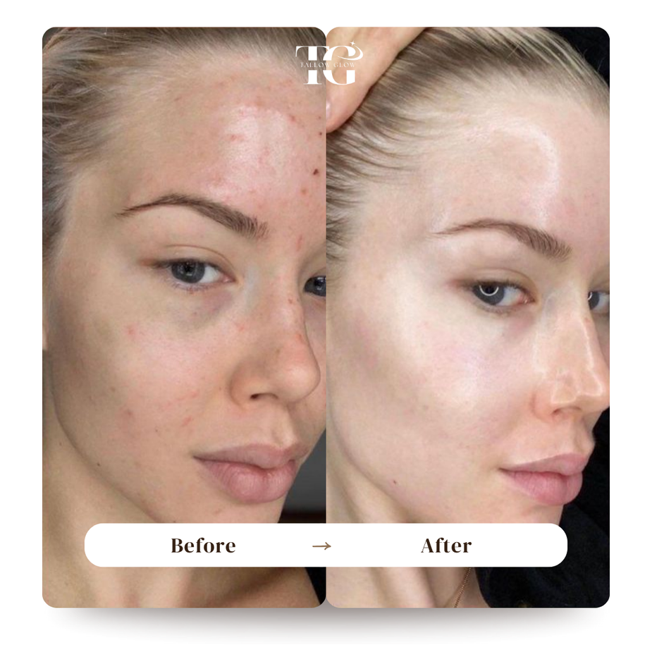 Tallow Glow | #1 Tallow in Nederland