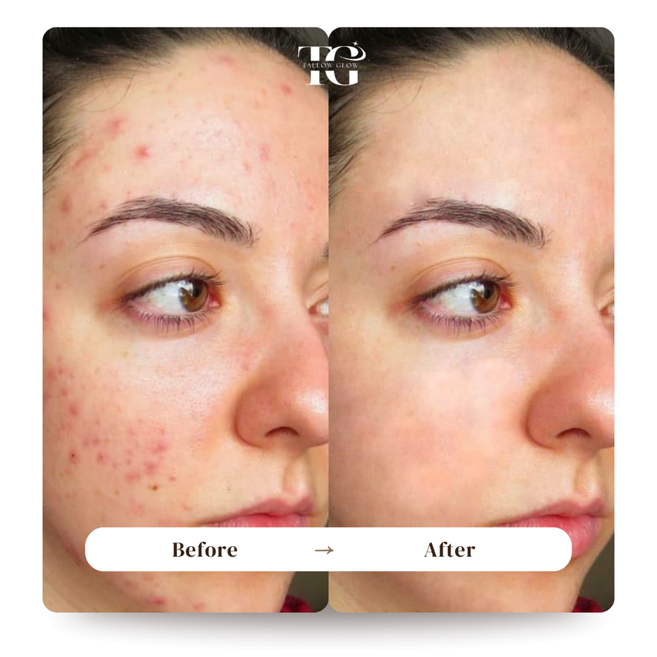 Tallow Glow | #1 Tallow in Nederland